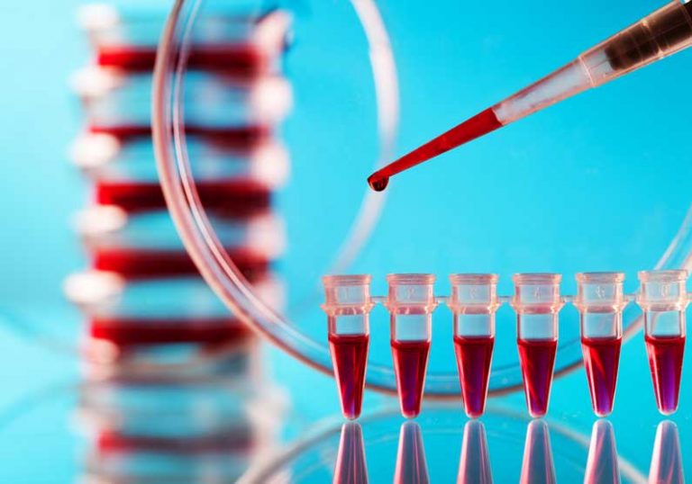 Human TNF transgenic mouse arthritis model for the preclinical testing ...