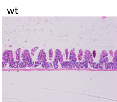 Inflammatory Bowel Disease (IBD) - Biomedcode