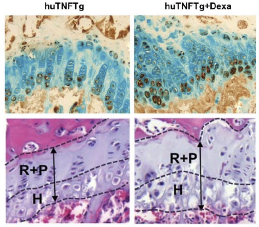 arthritis Archives - Biomedcode