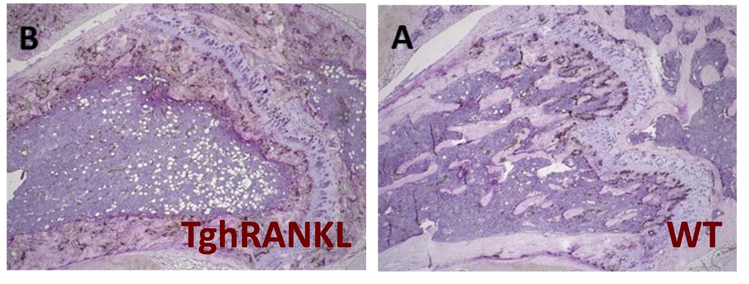 World Osteoporosis Day - Biomedcode